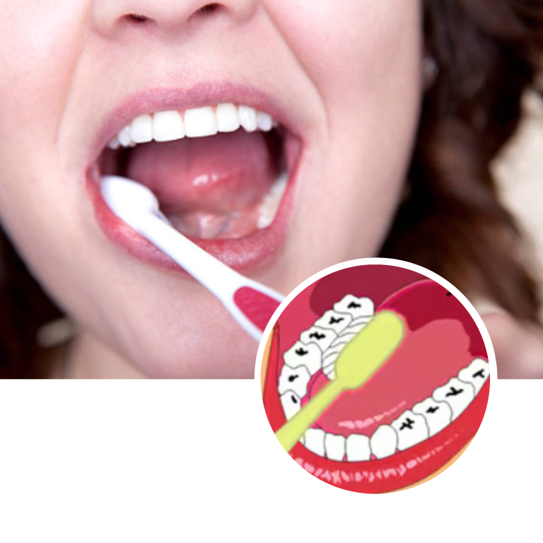 How to Brush and Floss Safely - Post-Extraction Oral Care